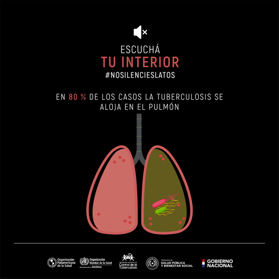 Programa Nacional de Control de Tuberculosis - DGVS