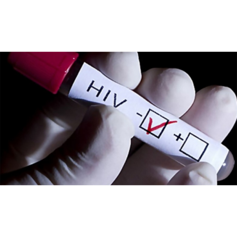 VIH: transmisión de la infección se da a través de fluidos corporales ...