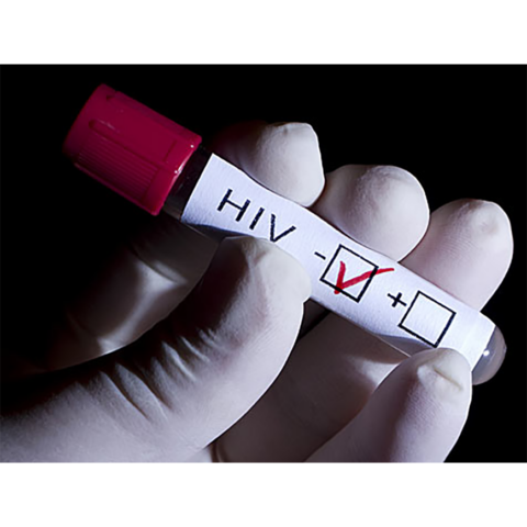 Vivir con VIH, la realidad sobre una infección crónica - DGVS